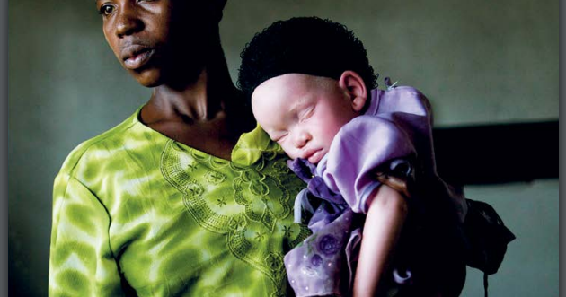 Manual of Best Practice: Skin Cancer Prevention and Management for ...